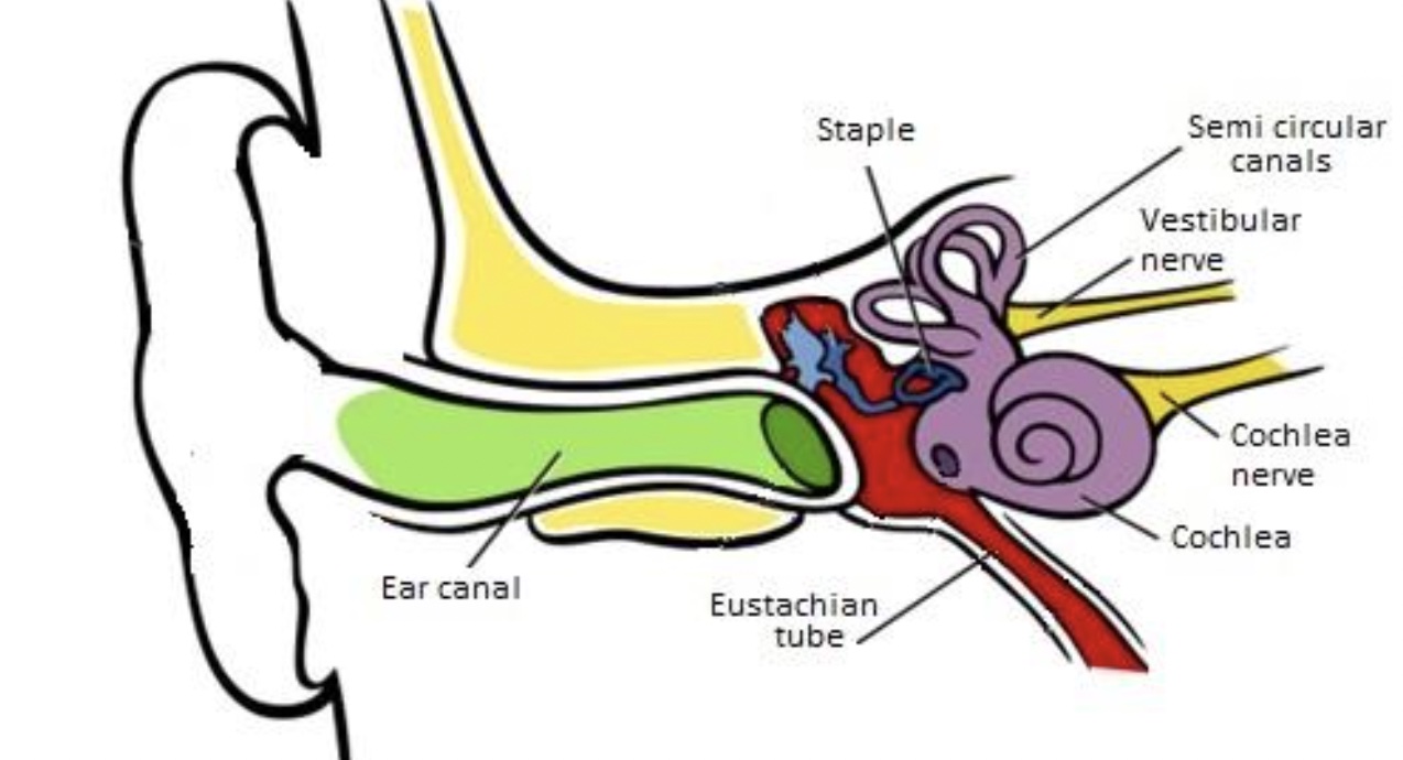 Benign Paroxysmal Positional Vertigo (BPPV) - Sydney Headache and ...